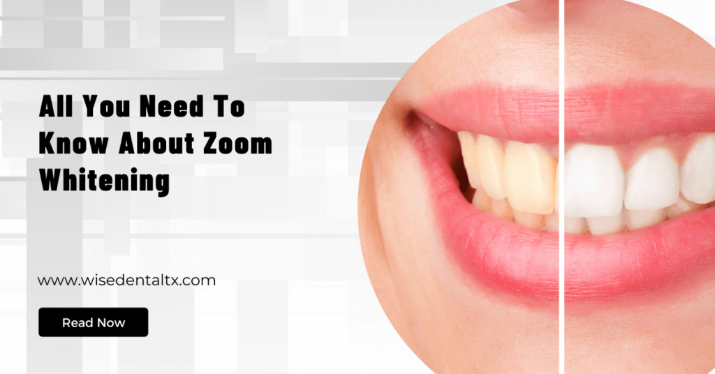 All You Need To Know About Zoom Whitening - Wise Dental