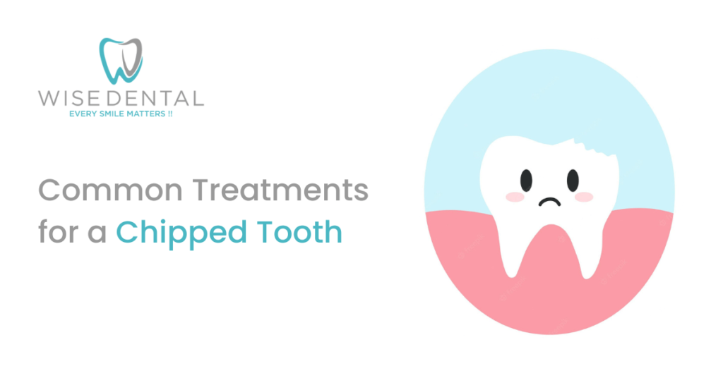 Common Treatments for a Chipped Tooth | Wise Dental